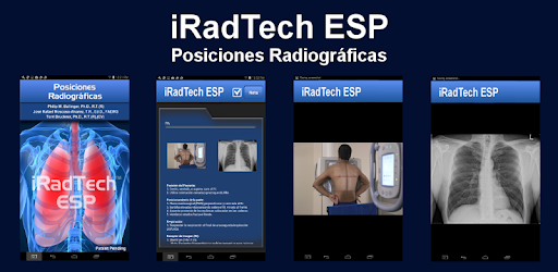 iRadTech ESP Android App